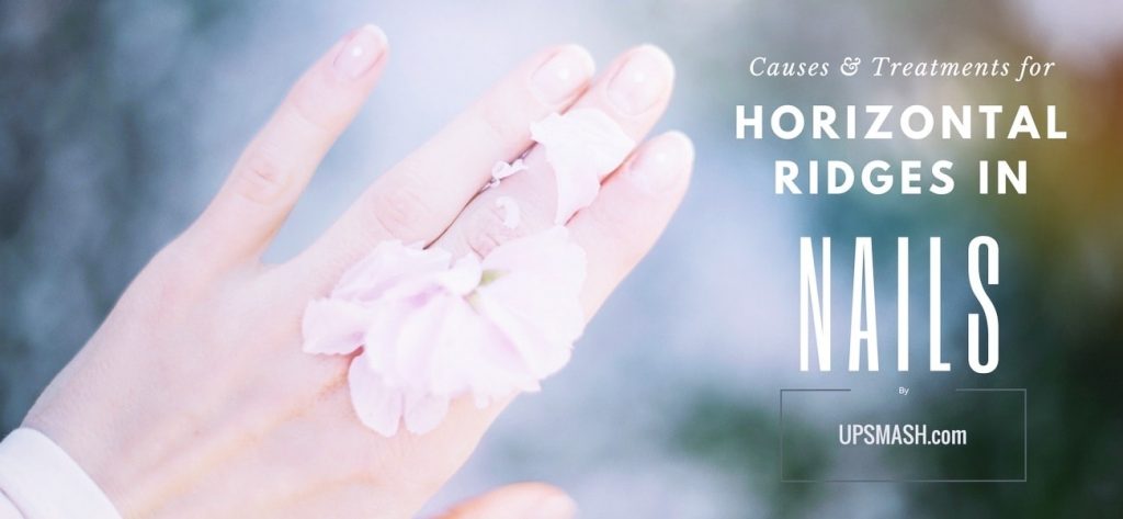 Horizontal Ridges in Nails – aka Beau Lines: Causes and Treatment - upsmash
